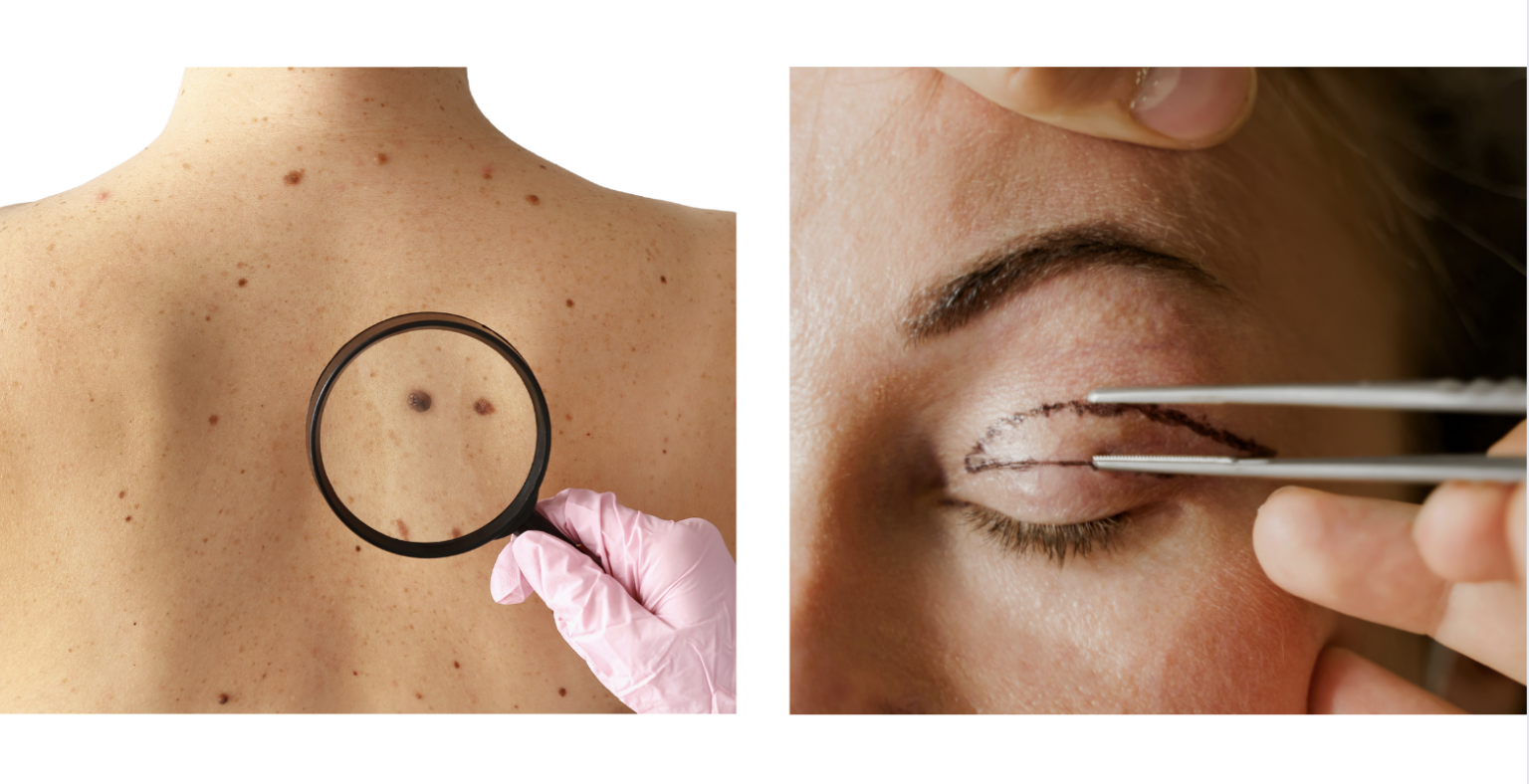 Cosmetic and Minor Surgery | Blog | Persona Medical Aesthetics