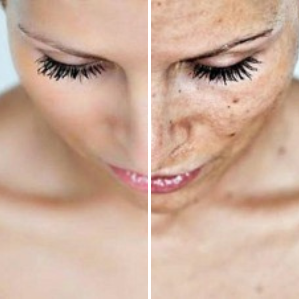 Photoaging vs Natural Ageing | Blog | Persona Medical Aesthetics